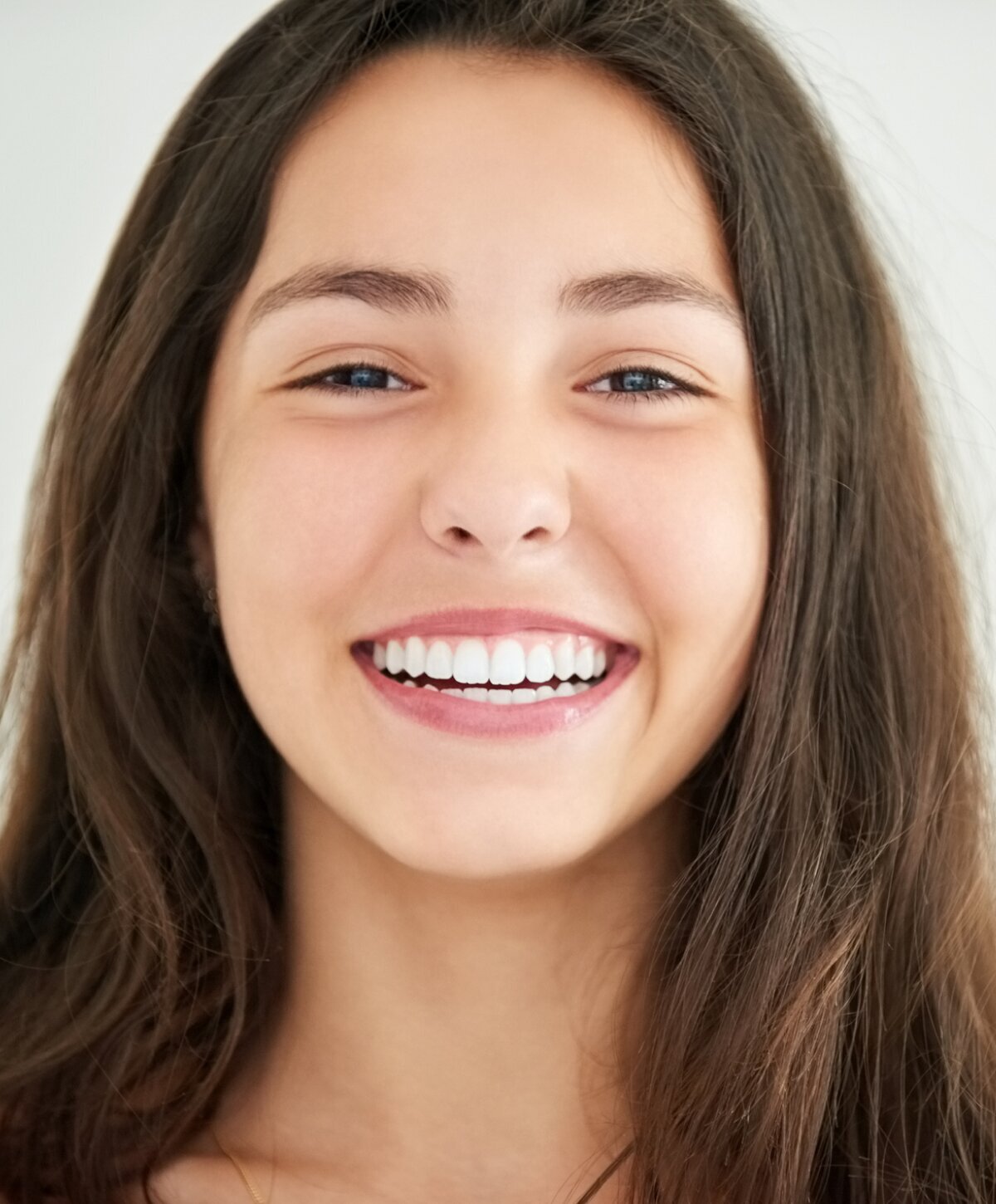 BBL Laramie | BroadBand Light | Ascent Medical Spa & Wellness